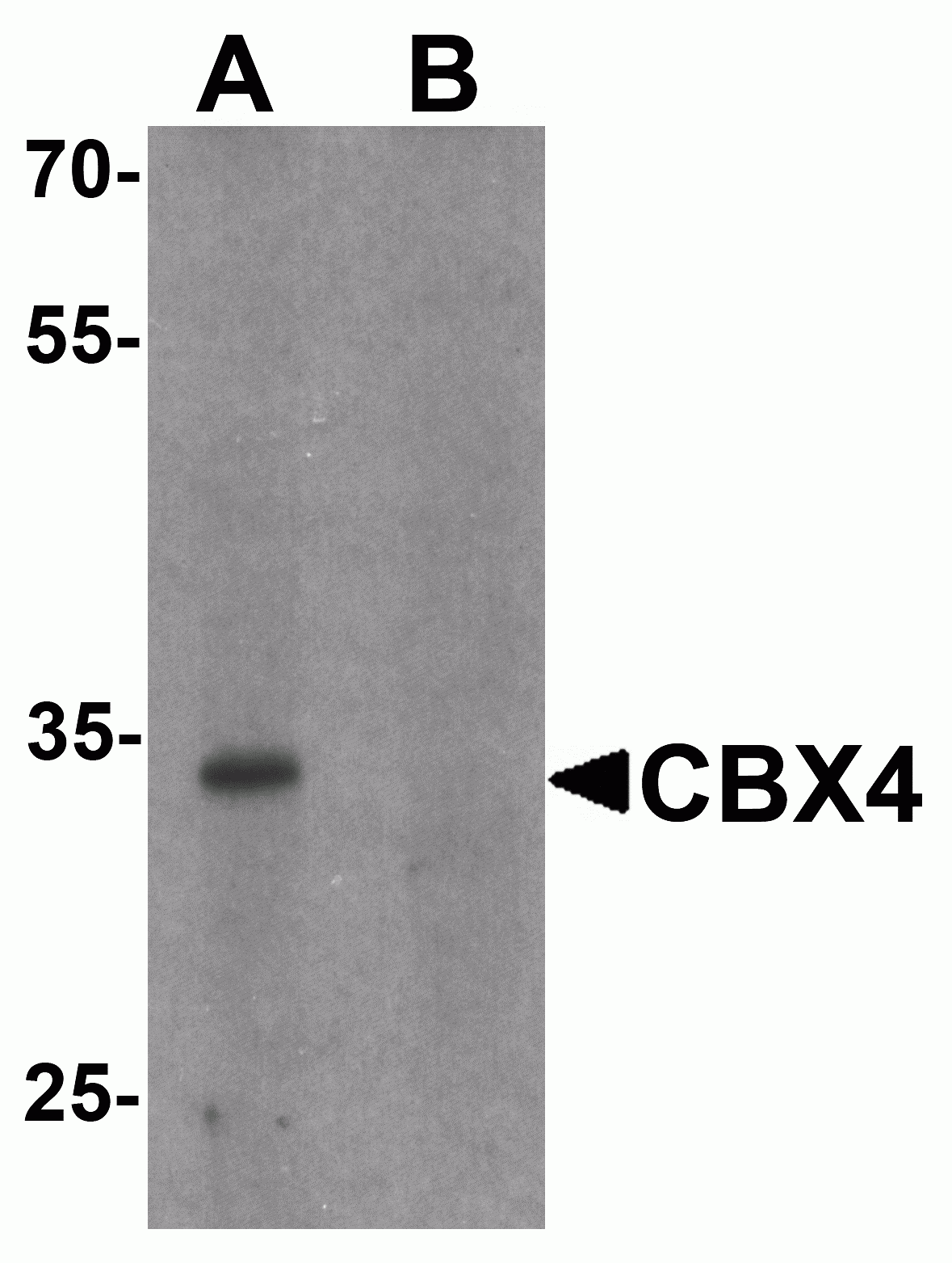 CBX4 Antibody - Cat. No. 7007 | ProSci
