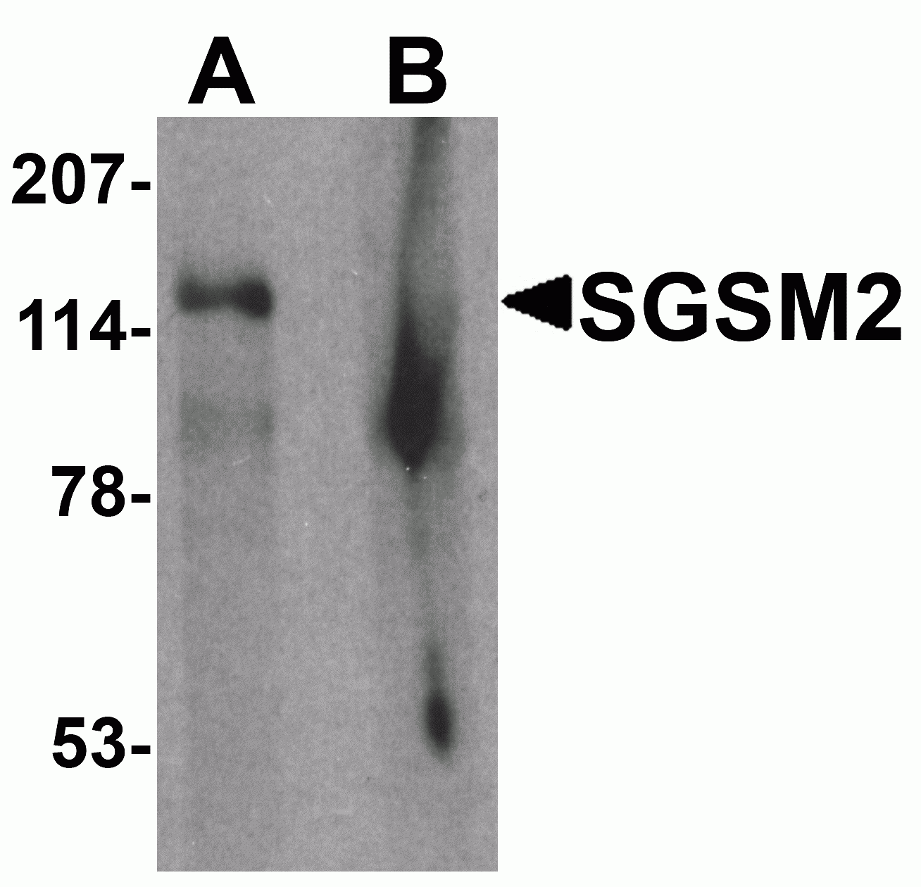 SGSM2 Antibody - Cat. No. 7035 | ProSci