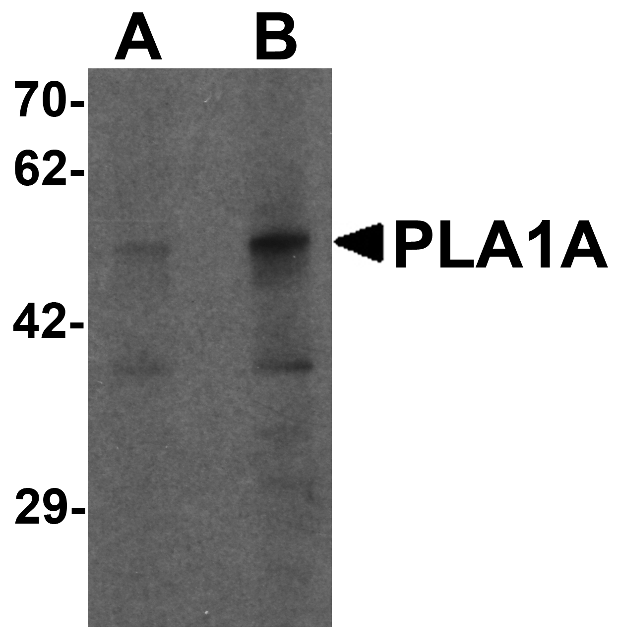 PLA1A Antibody - Cat. No. 7059 | ProSci
