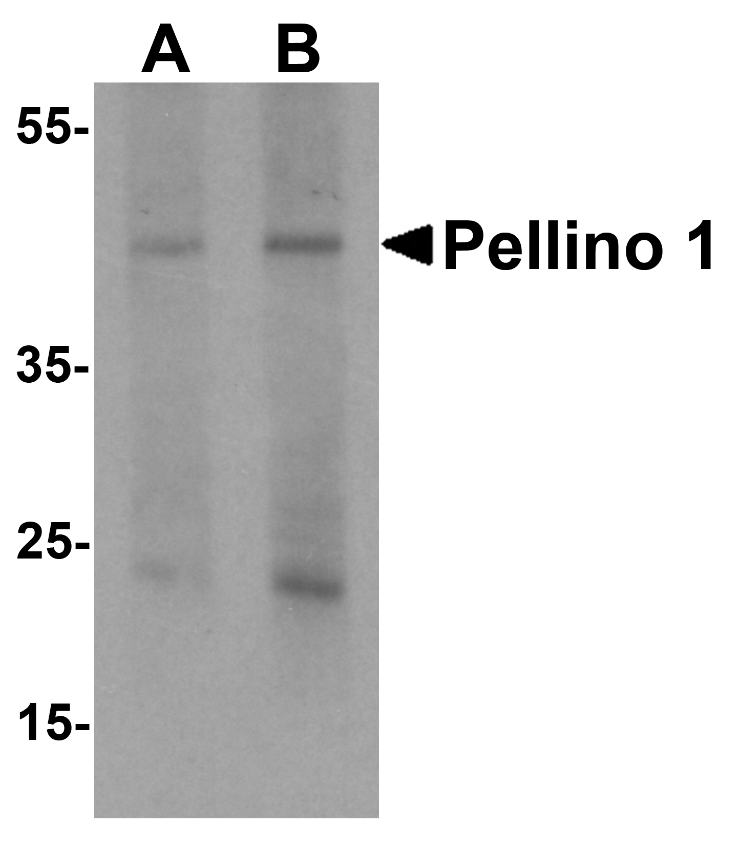 Pellino 1 Antibody - Cat. No. 7071 | ProSci