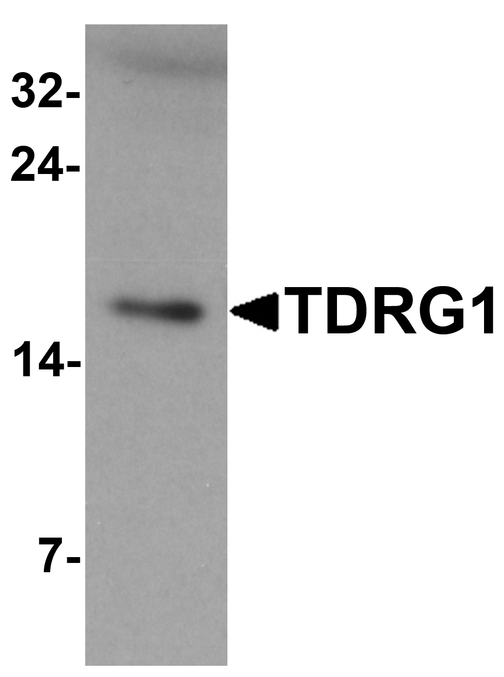 TDRG1 Antibody - Cat. No. 7105 | ProSci
