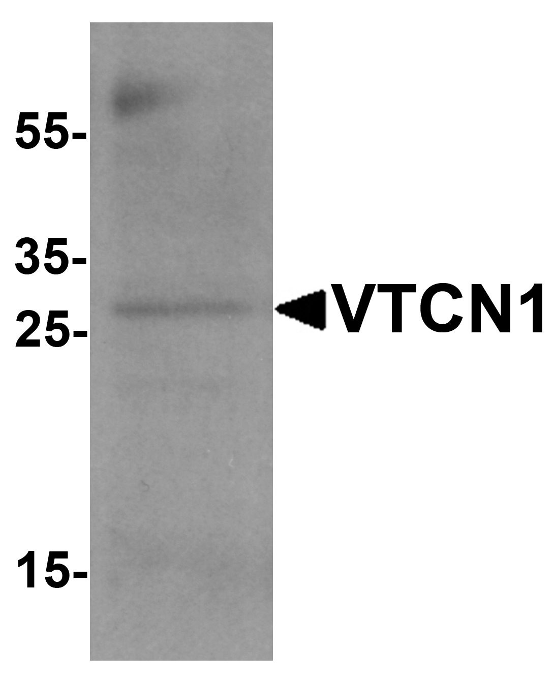 VTCN1 Antibody - Cat. No. 7189 | ProSci