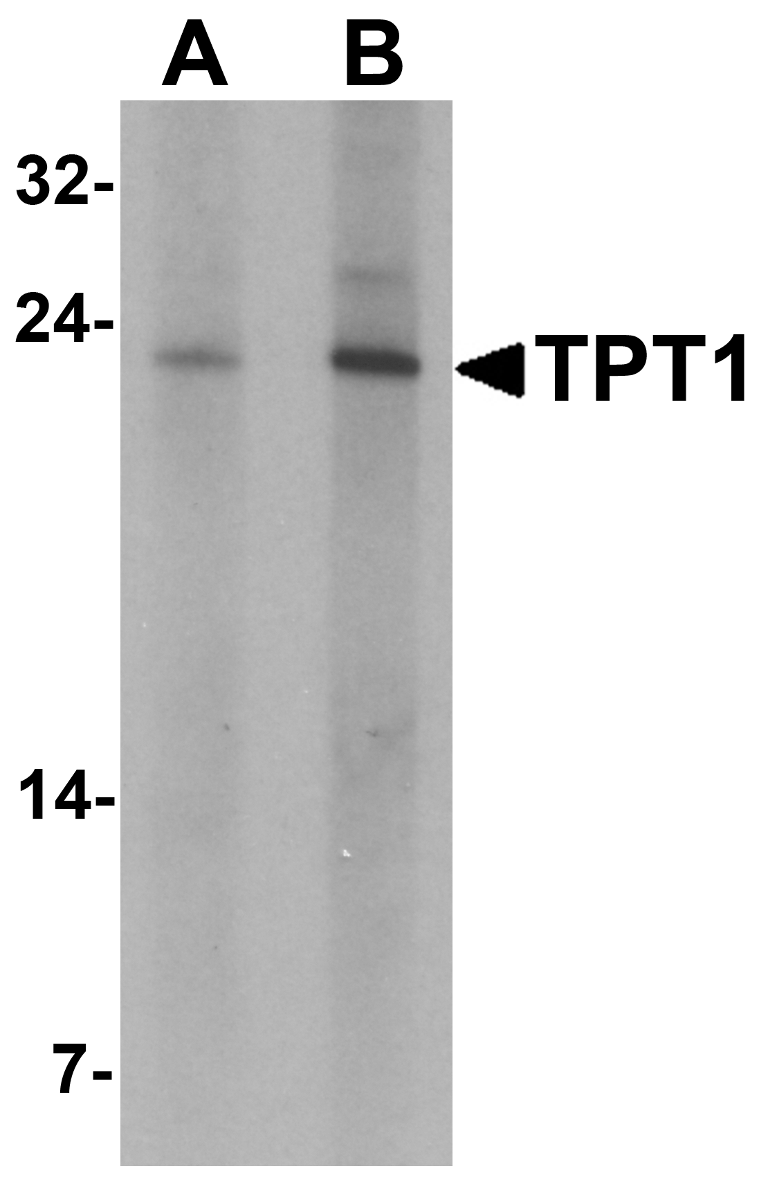 TPT1 Antibody - Cat. No. 7193 | ProSci