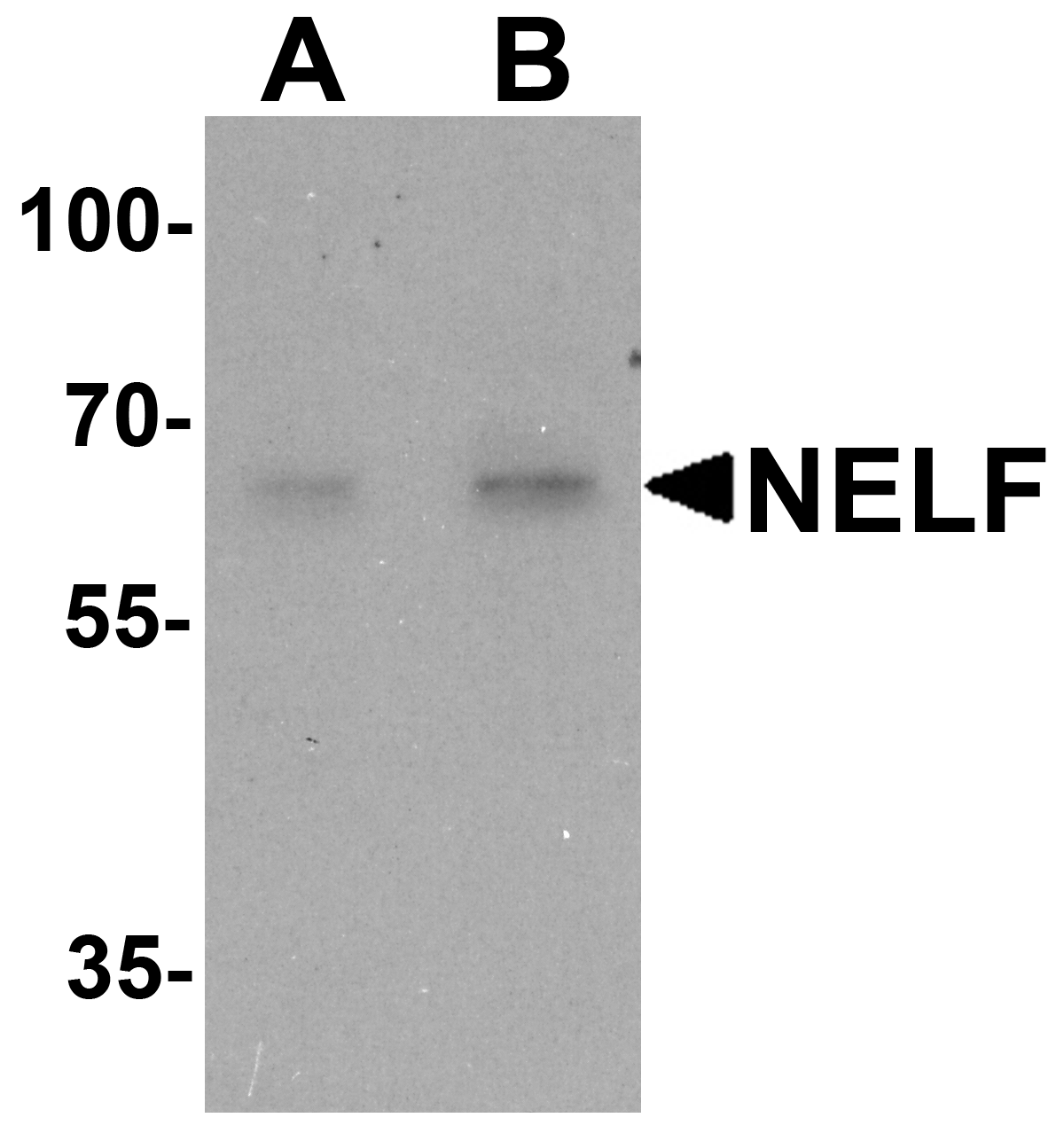 NELF Antibody - Cat. No. 7225 | ProSci