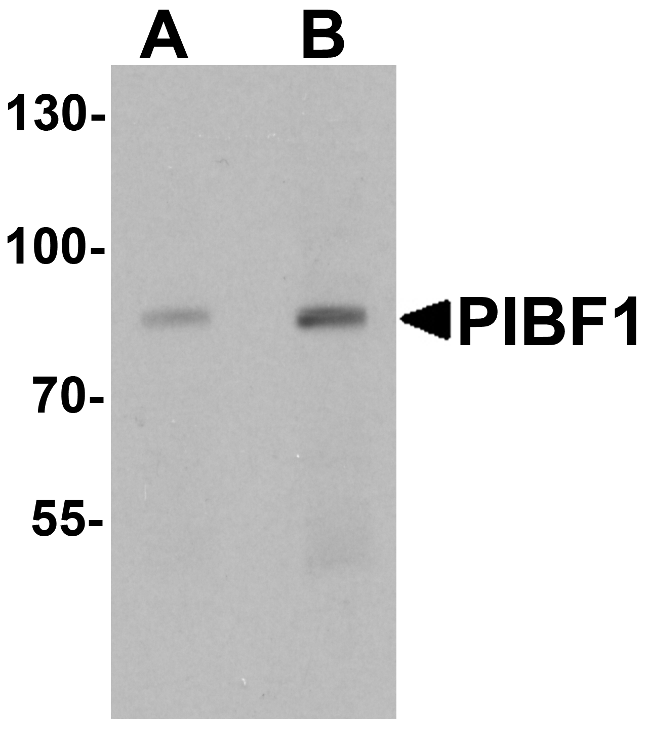 PIBF1 Antibody - Cat. No. 7237 | ProSci