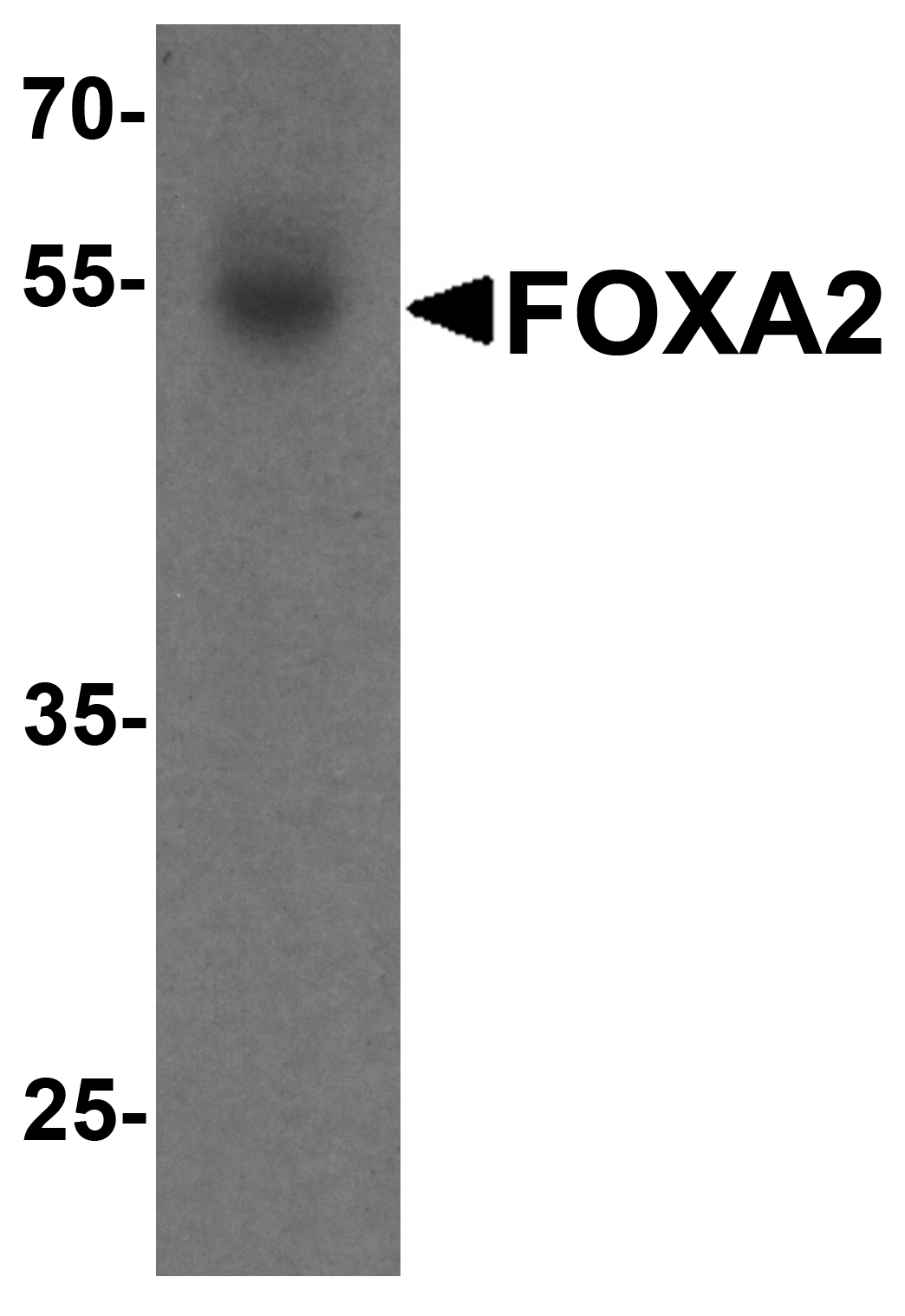 FOXA2 Antibody - Cat. No. 7257 | ProSci