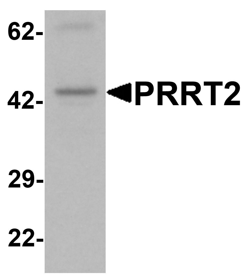 PRRT2 Antibody - Cat. No. 7295 | ProSci