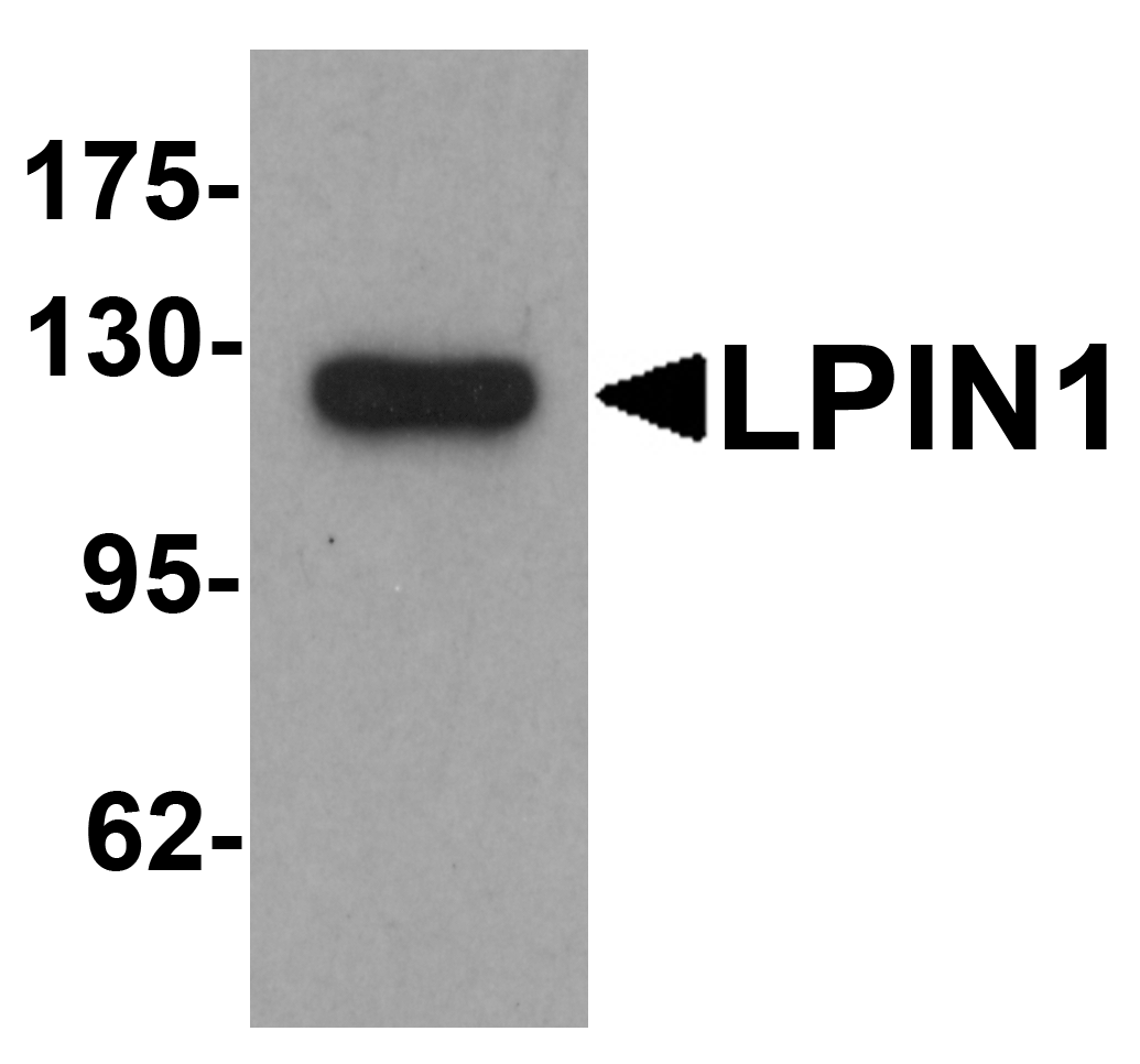 LPIN1 Antibody - Cat. No. 7393 | ProSci