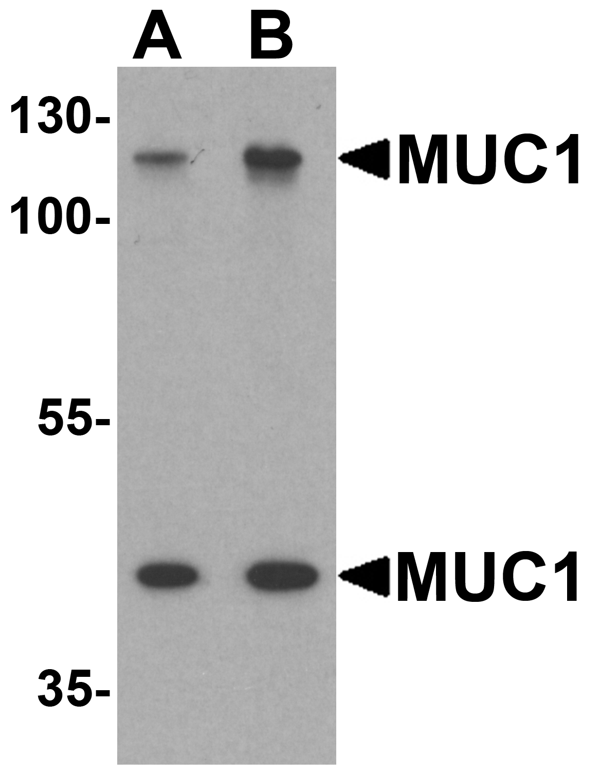 MUC1 Antibody - Cat. No. 7451 | ProSci