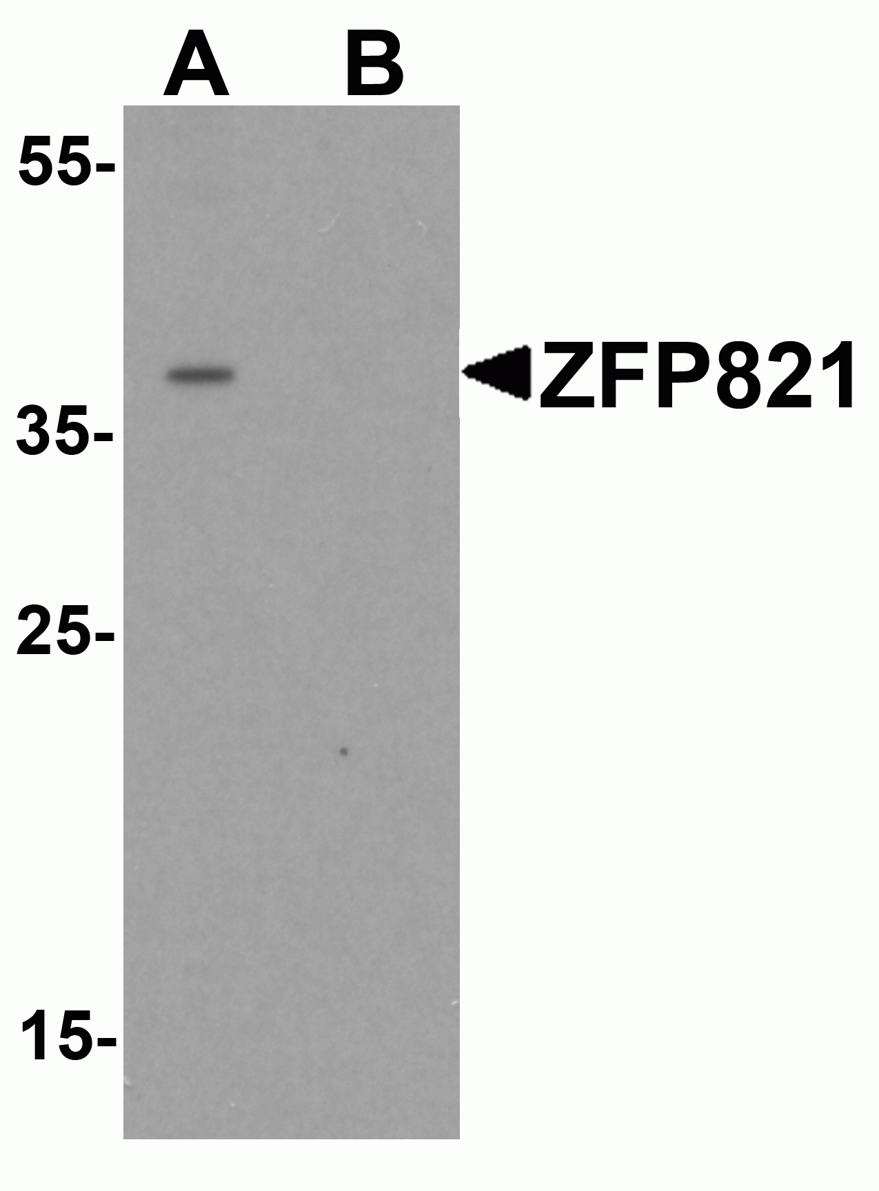 ZNF821 Antibody - Cat. No. 7537 | ProSci