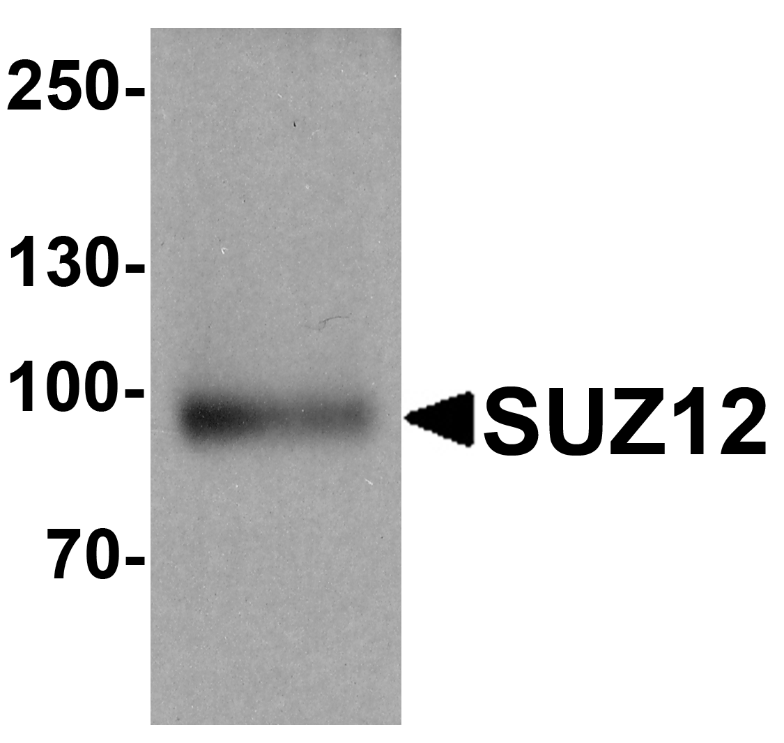 SUZ12 Antibody - Cat. No. 7701 | ProSci