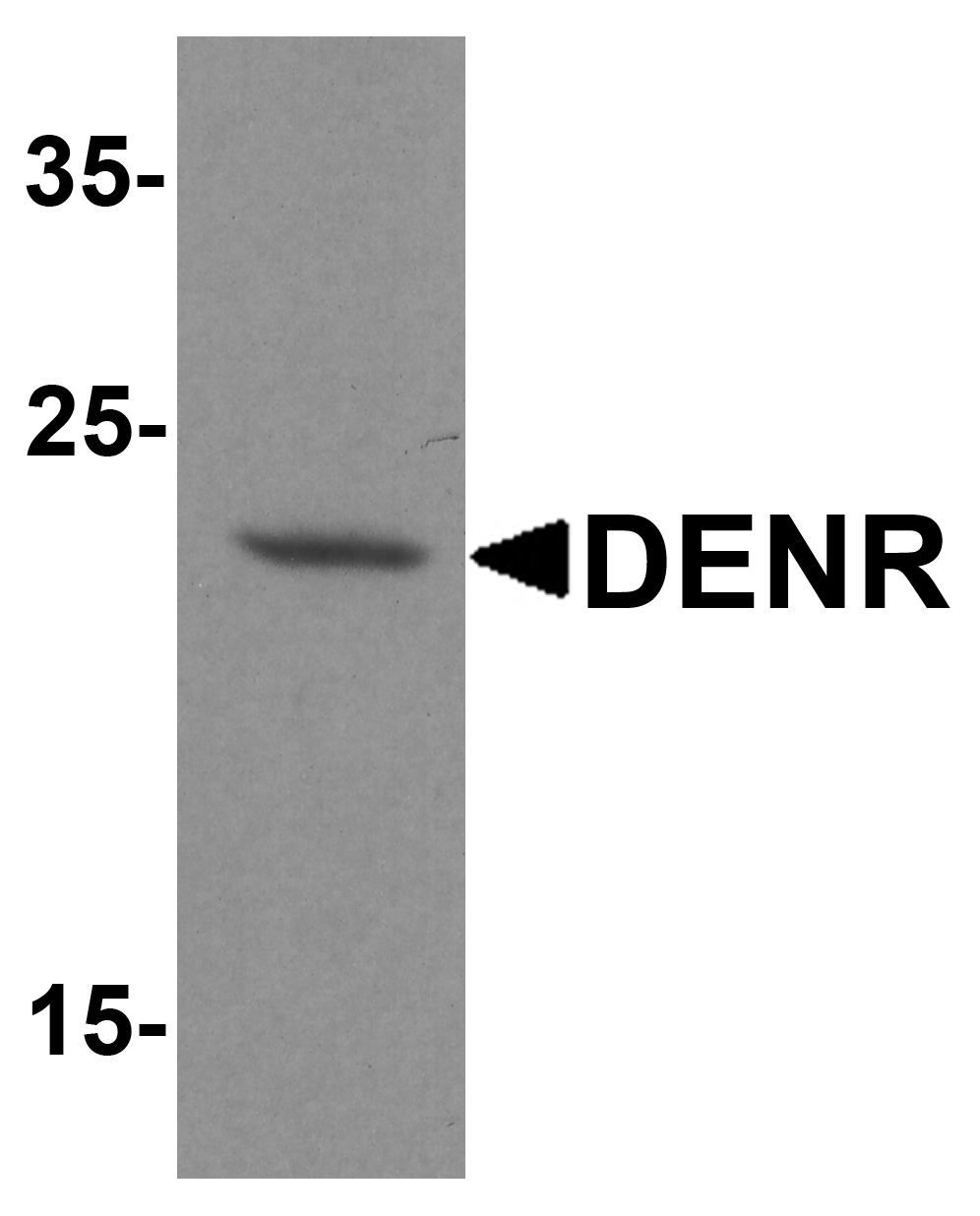 DENR Antibody - Cat. No. 7755 | ProSci