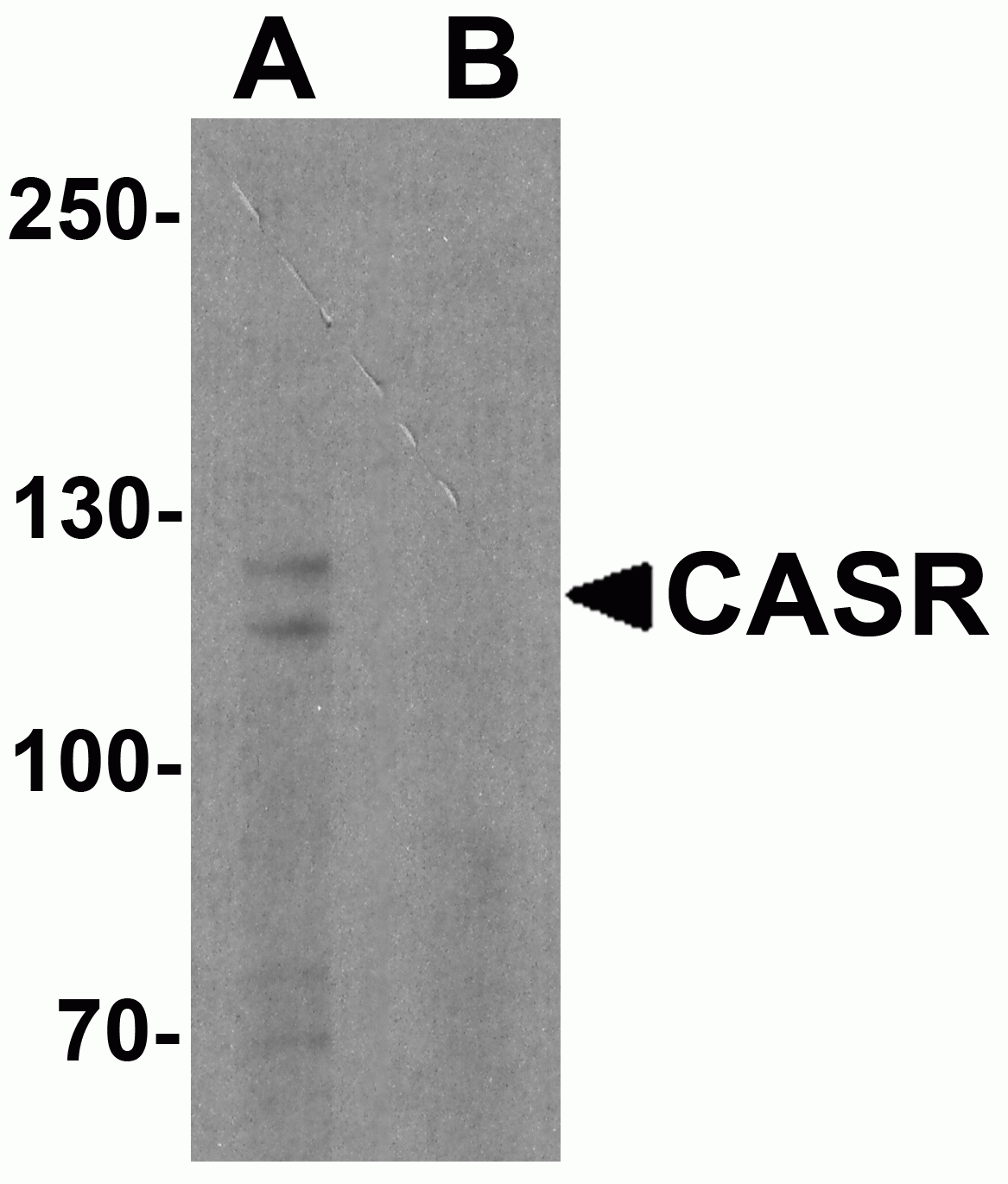 CASR Antibody - Cat. No. 7785 | ProSci