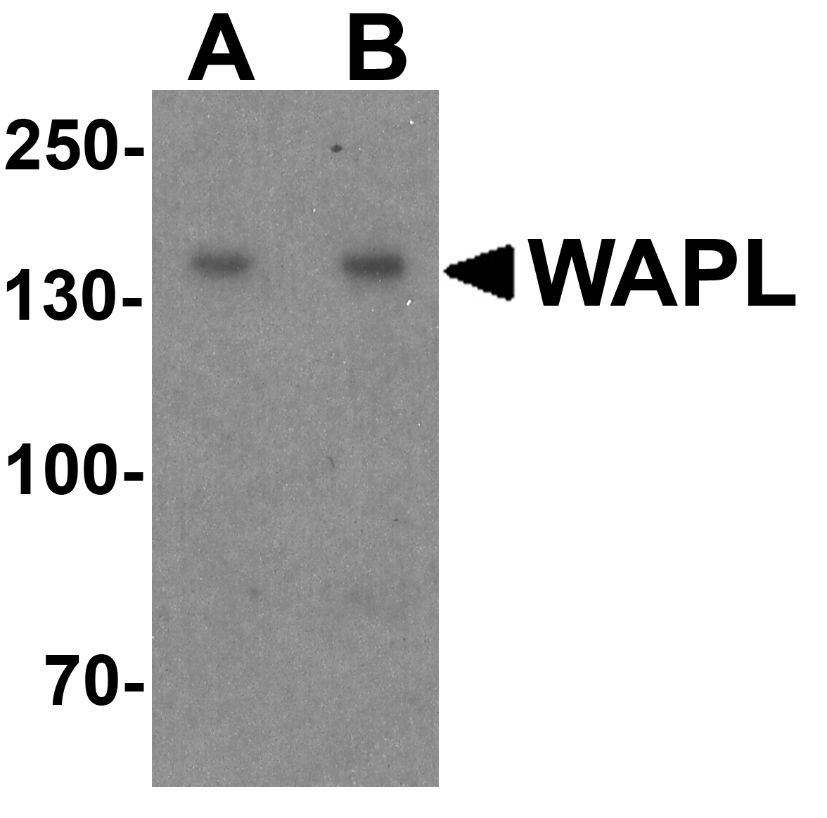 WAPL Antibody - Cat. No. 7799 | ProSci