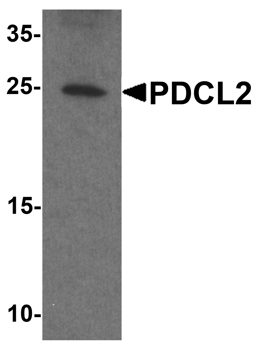 PDCL2 Antibody - Cat. No. 7887 | ProSci
