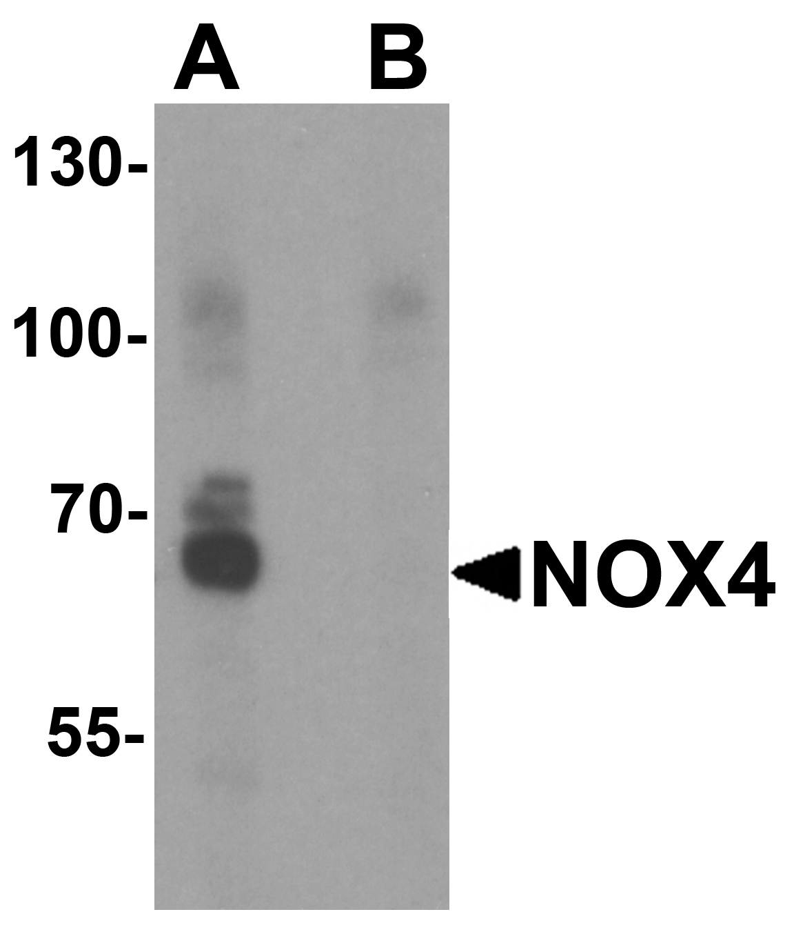 NOX4 Antibody - Cat. No. 7927 | ProSci