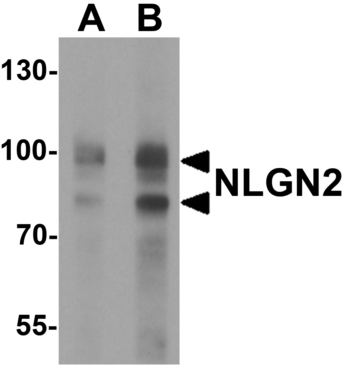 NLGN2 Antibody - Cat. No. 7969 | ProSci