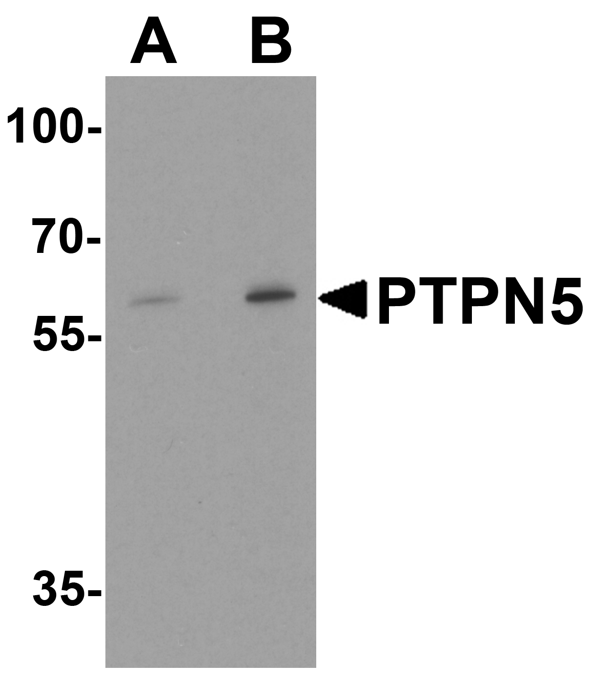 PTPN5 Antibody - Cat. No. 8013 | ProSci