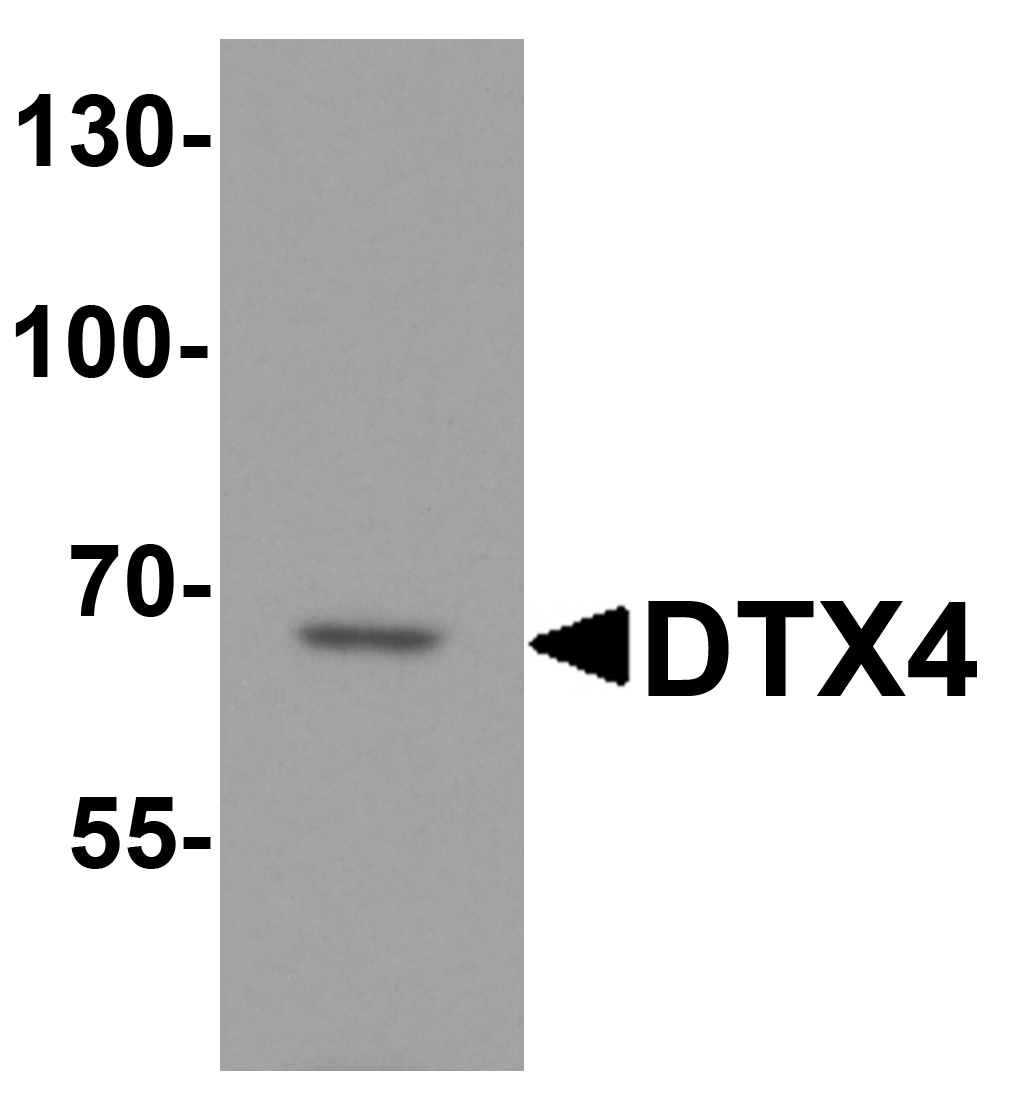 DTX4 Antibody - Cat. No. 8057 | ProSci
