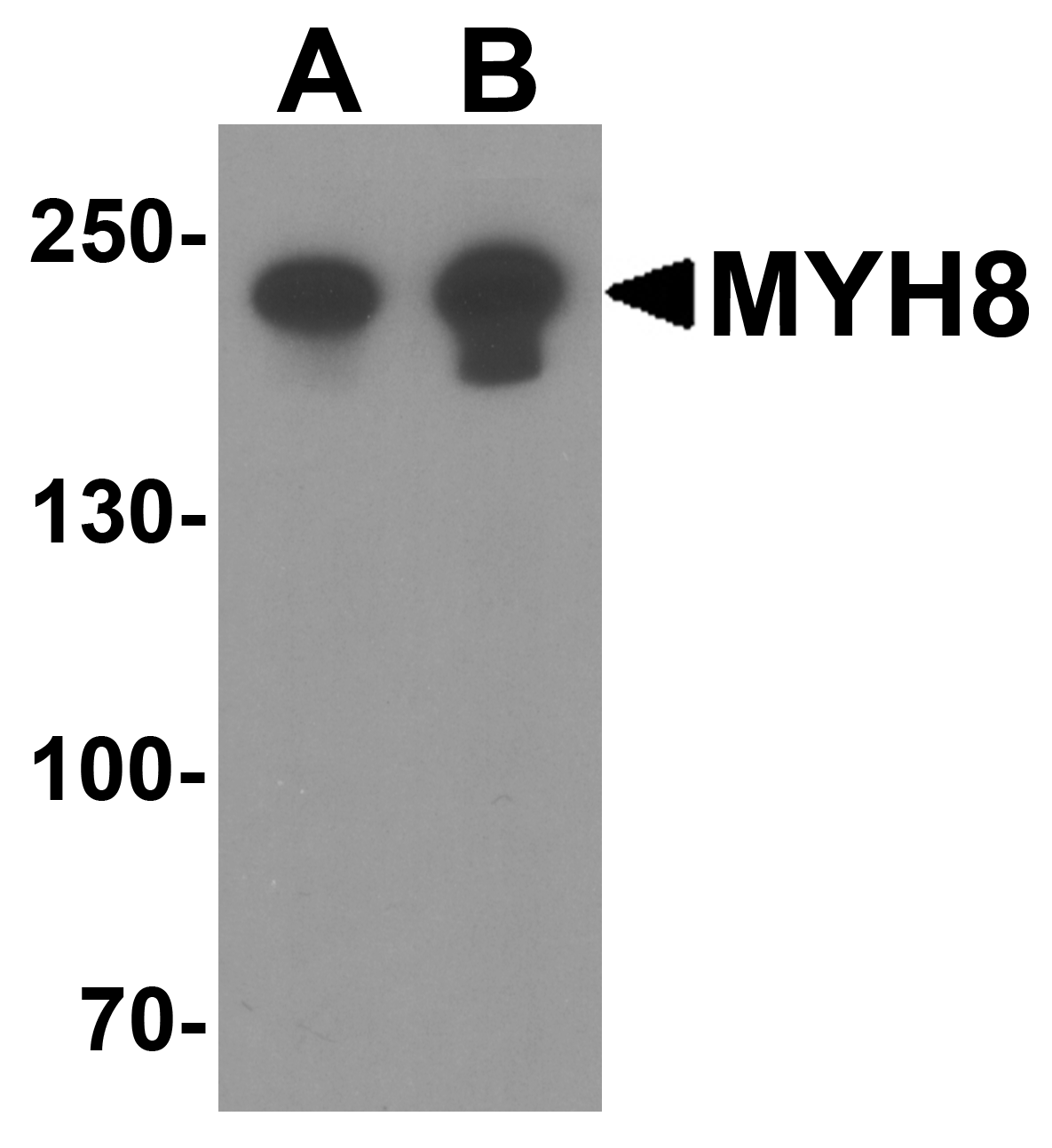 MYH8 Antibody - Cat. No. 8081 | ProSci