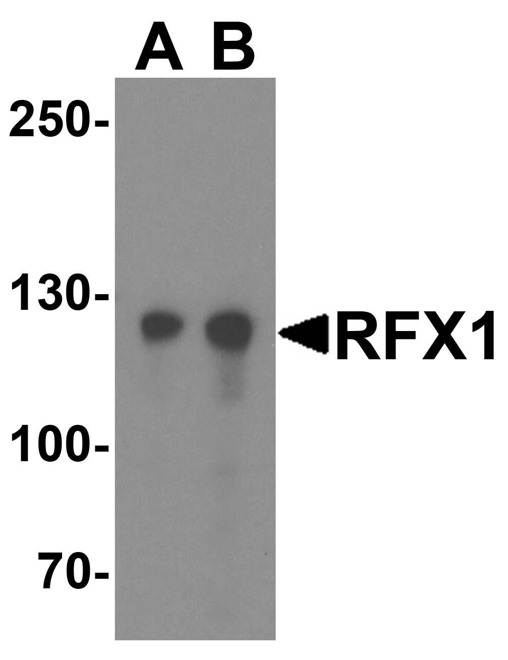 RFX1 Antibody - Cat. No. 8199 | ProSci