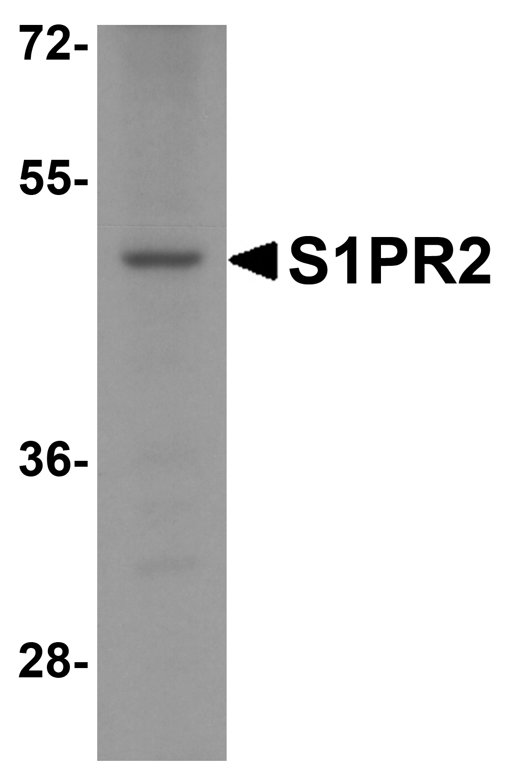 S1PR2 Antibody - Cat. No. 8229 | ProSci