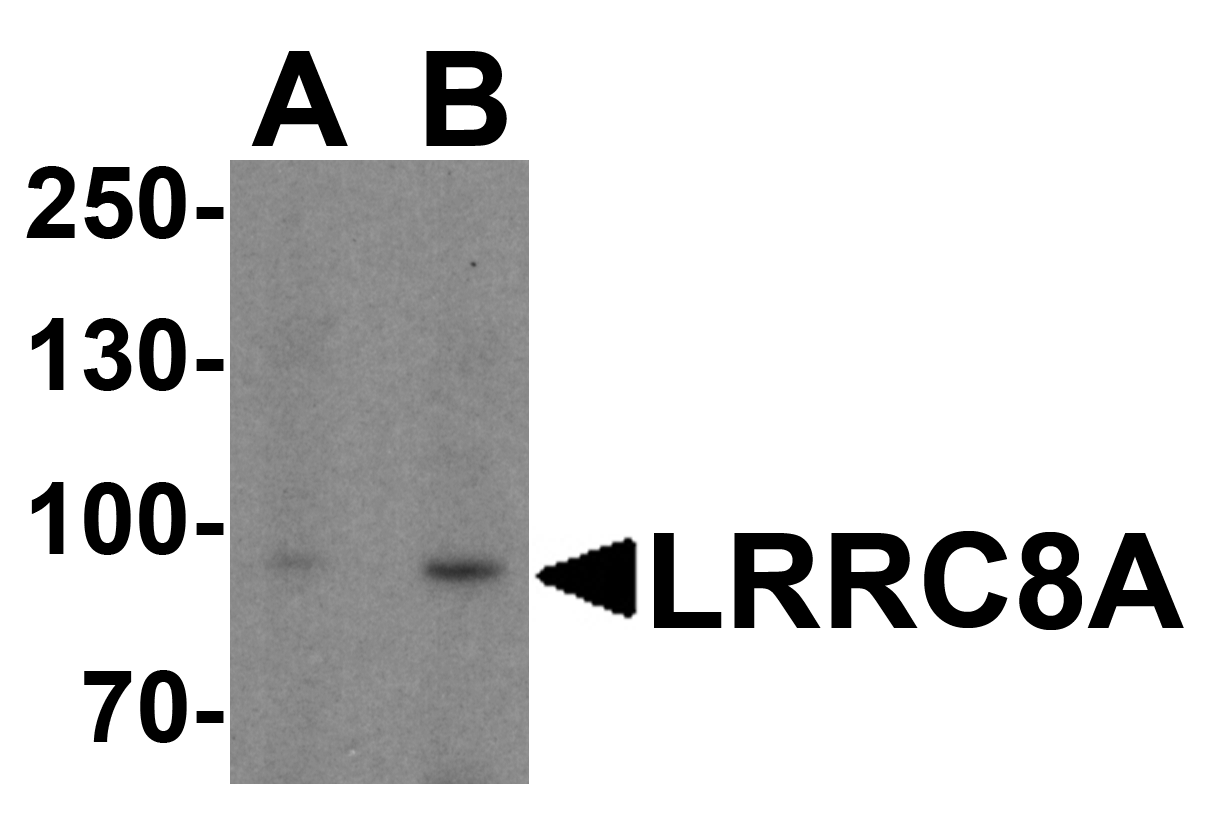 LRRC8A Antibody - Cat. No. 8235 | ProSci