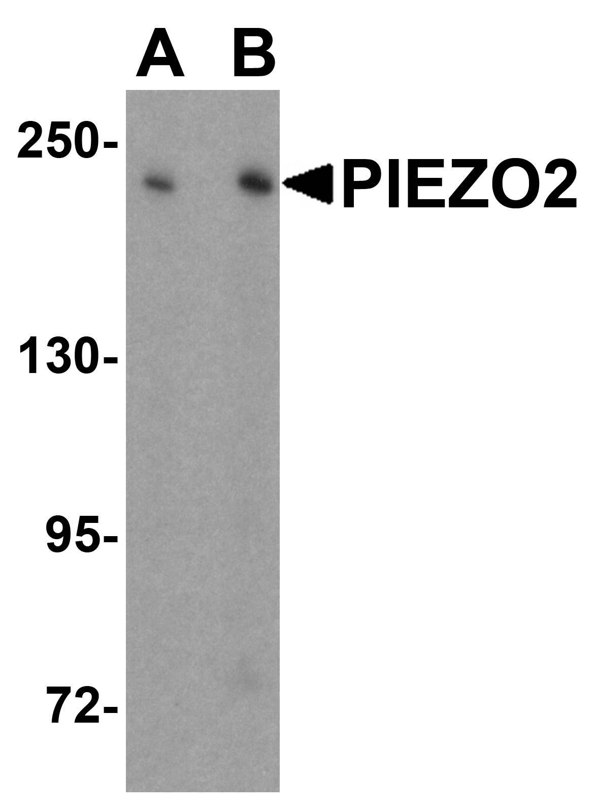 PIEZO2 Antibody - Cat. No. 8613 | ProSci
