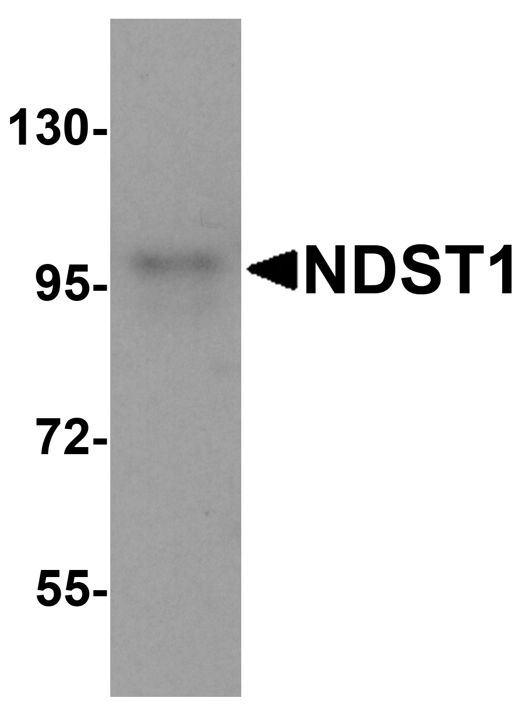NDST1 Antibody - Cat. No. 8615 | ProSci