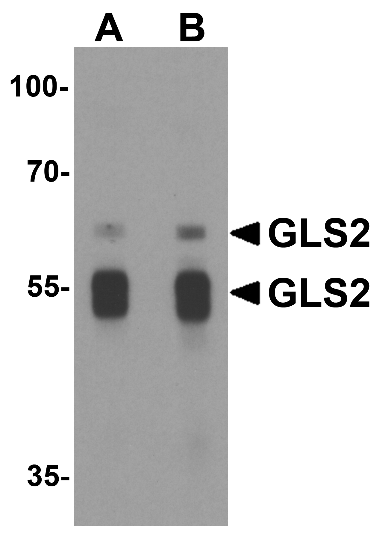 GLS2 Antibody - Cat. No. 6217 | ProSci