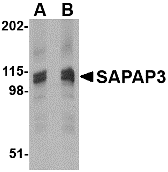 SAPAP Detection Set - Cat. No. PSI-1826 | ProSci