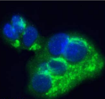 Alpha-fetoprotein (AFP) Antibody [AF5], Rabbit IgG | ProSci Incorporated