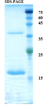 Interleukin 2 Recombinant Protein | ProSci Incorporated