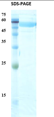 Treponema pallidum (Syphilis) p17/p47 Fusion Recombinant Protein ...