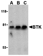 BTK Antibody - Cat. No. 3395 | ProSci