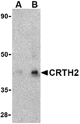 CRTH2 Antibody - Cat. No. 4029 | ProSci