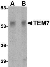 TEM7 Antibody - Cat. No. 4341 | ProSci