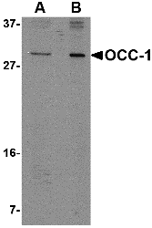 OCC-1 Antibody - Cat. No. 4987 | ProSci