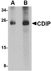 CDIP Antibody - Cat. No. 5047 | ProSci