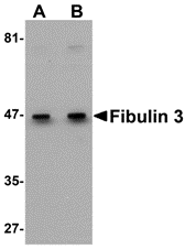 Fibulin 3 Antibody - Cat. No. 5213 | ProSci