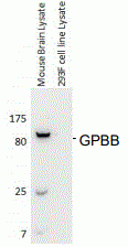 GPBB Antibody [E9B10] - Cat. No. 54-306 | ProSci