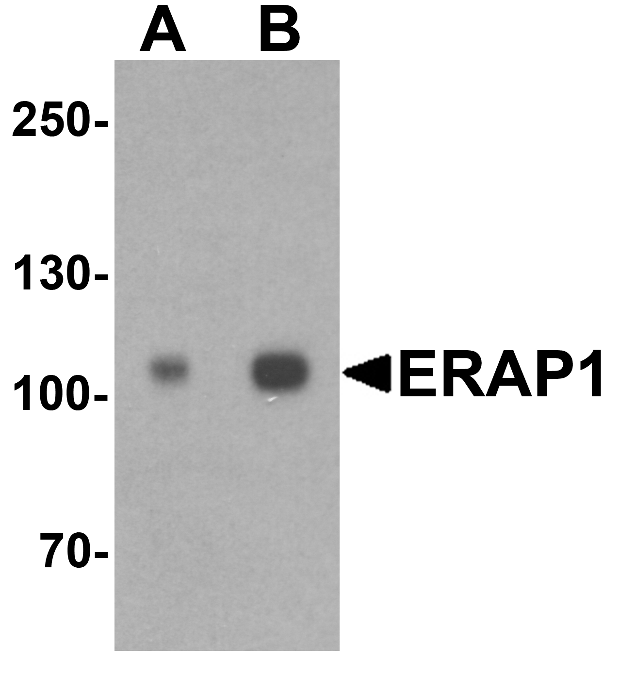 ERAP1 Antibody - Cat. No. 7467 | ProSci
