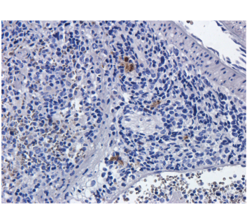 IL-2R alpha (CD25) Antibody [Basiliximab], Human IgG1 - Research Grade ...