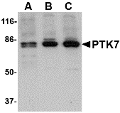 PTK7 Antibody - Cat. No. 4299 | ProSci