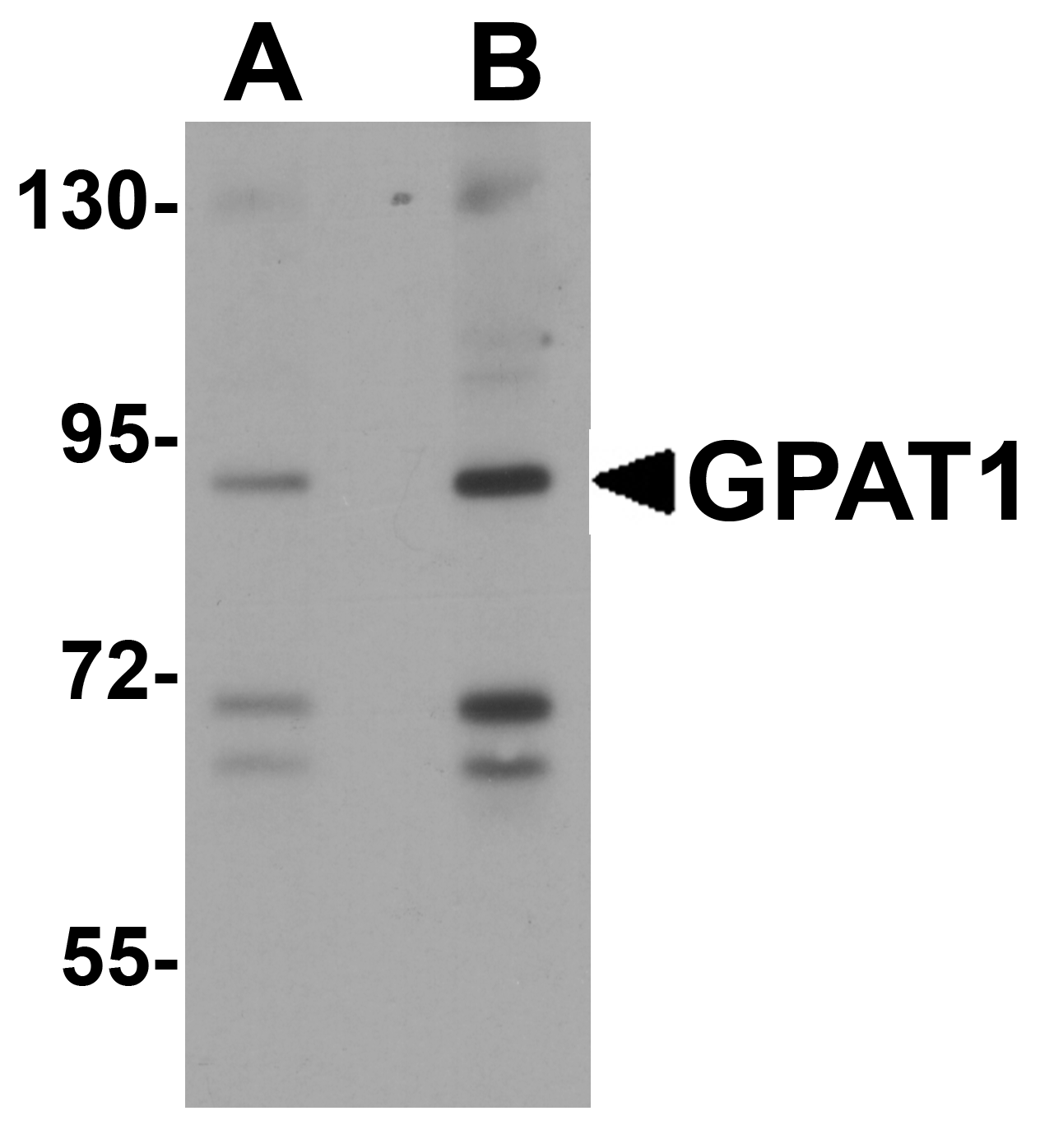 GPAT1 Antibody - Cat. No. 4613 | ProSci