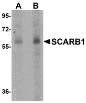 SCARB1 Antibody - Cat. No. 5193 | ProSci