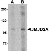 JMJD2A Antibody - Cat. No. 5373 | ProSci