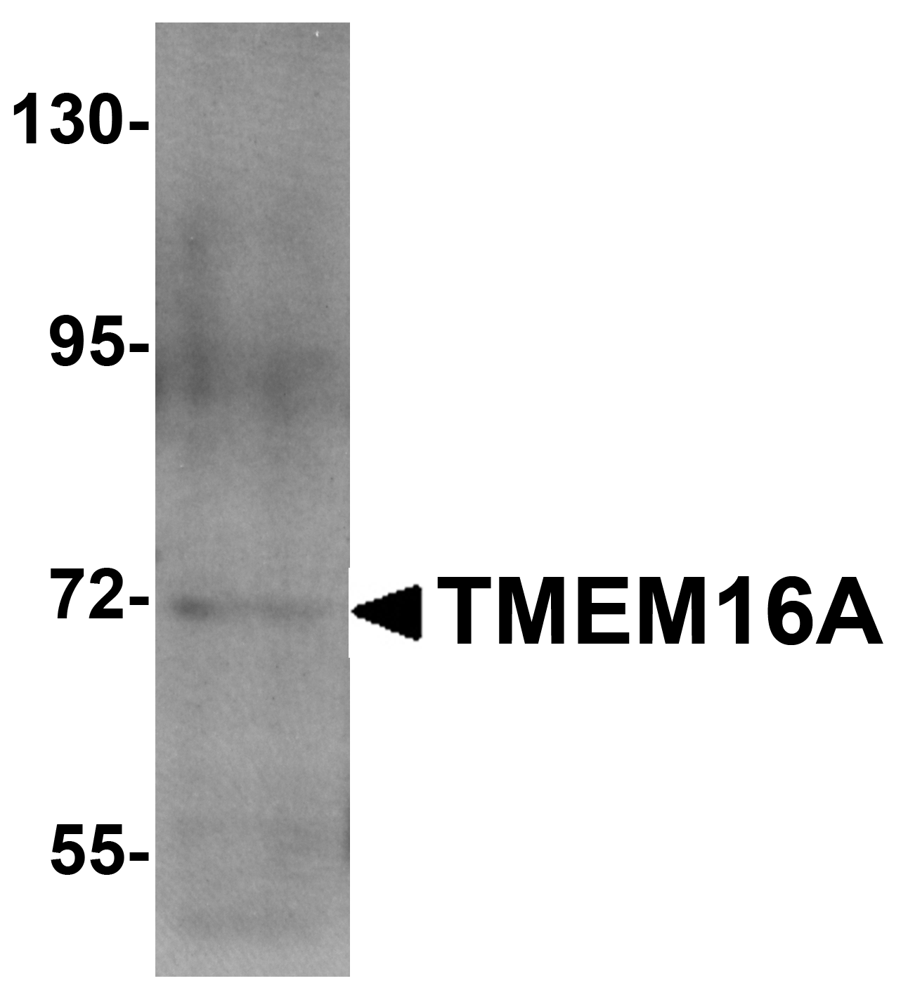 TMEM16A Antibody - Cat. No. 5419 | ProSci