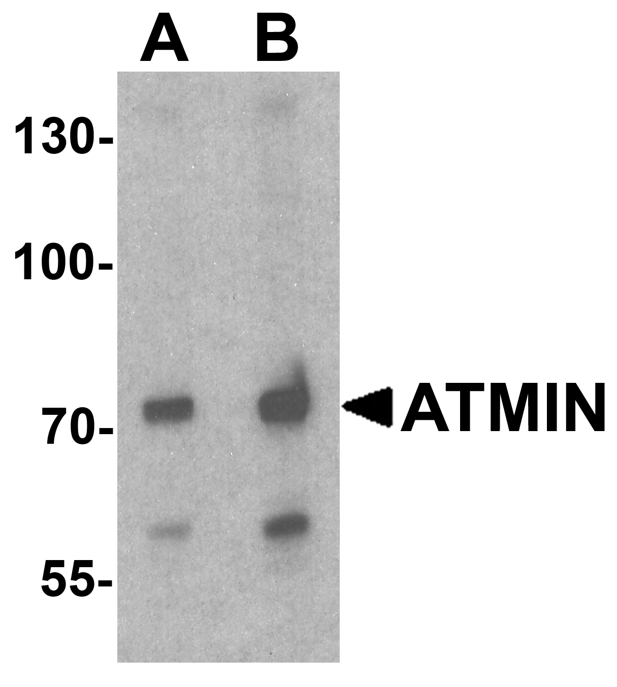 ATMIN Antibody - Cat. No. 7777 | ProSci