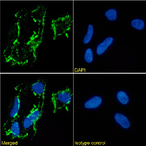 CD56 Antibody [NCAM12.19], Mouse IgG1 | ProSci Incorporated